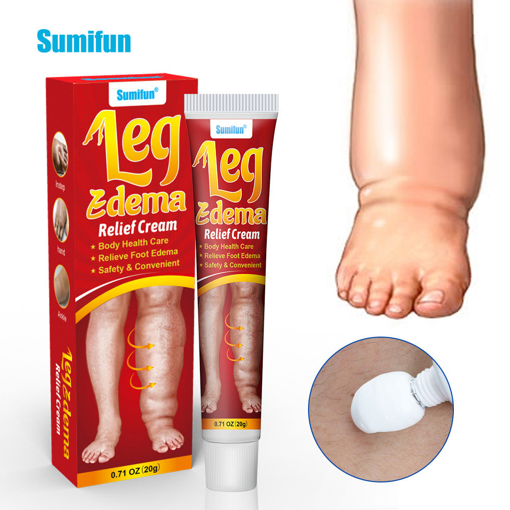 Leg Edema Relief Cream | Topical Cream for Foot Edema | Ginax Store