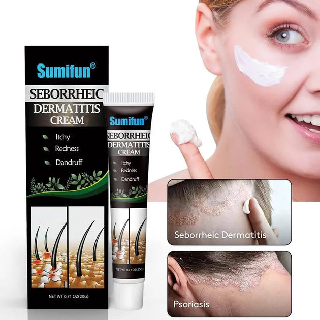 Seborrheic Dermatitis Cream | Herbal Cream for Treating Dermatitis, Ps ...