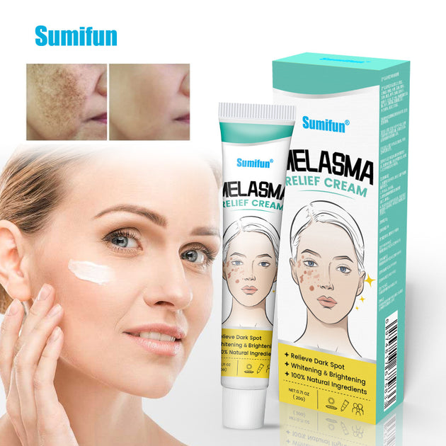 Melasma Relief Cream | Topical Cream for Chloasma and Dark Spots ...