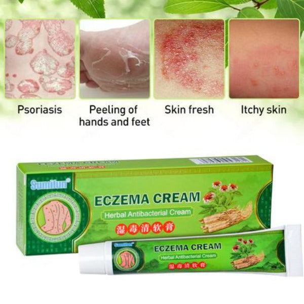 Eczema Cream | Herbal Cream for Treating Eczema, Psoriasis, and Skin I ...